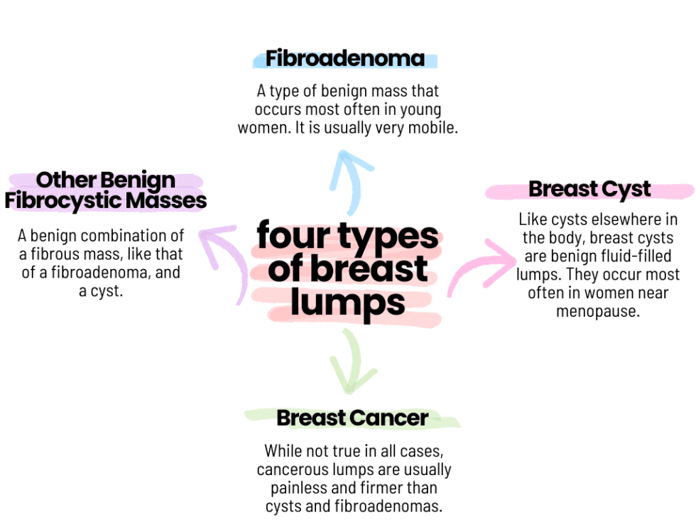 Are All Breast Lumps Breast Cancer? | Maurer Foundation